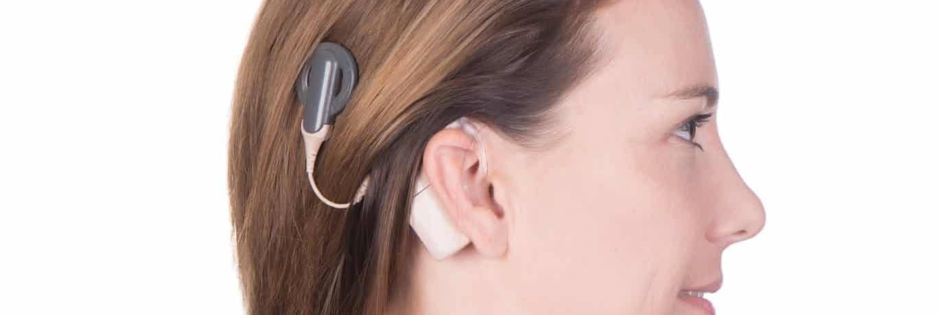 Implantable Hearing Devices - Landrum ENT Implantable Hearing Devices - Landrum ENT